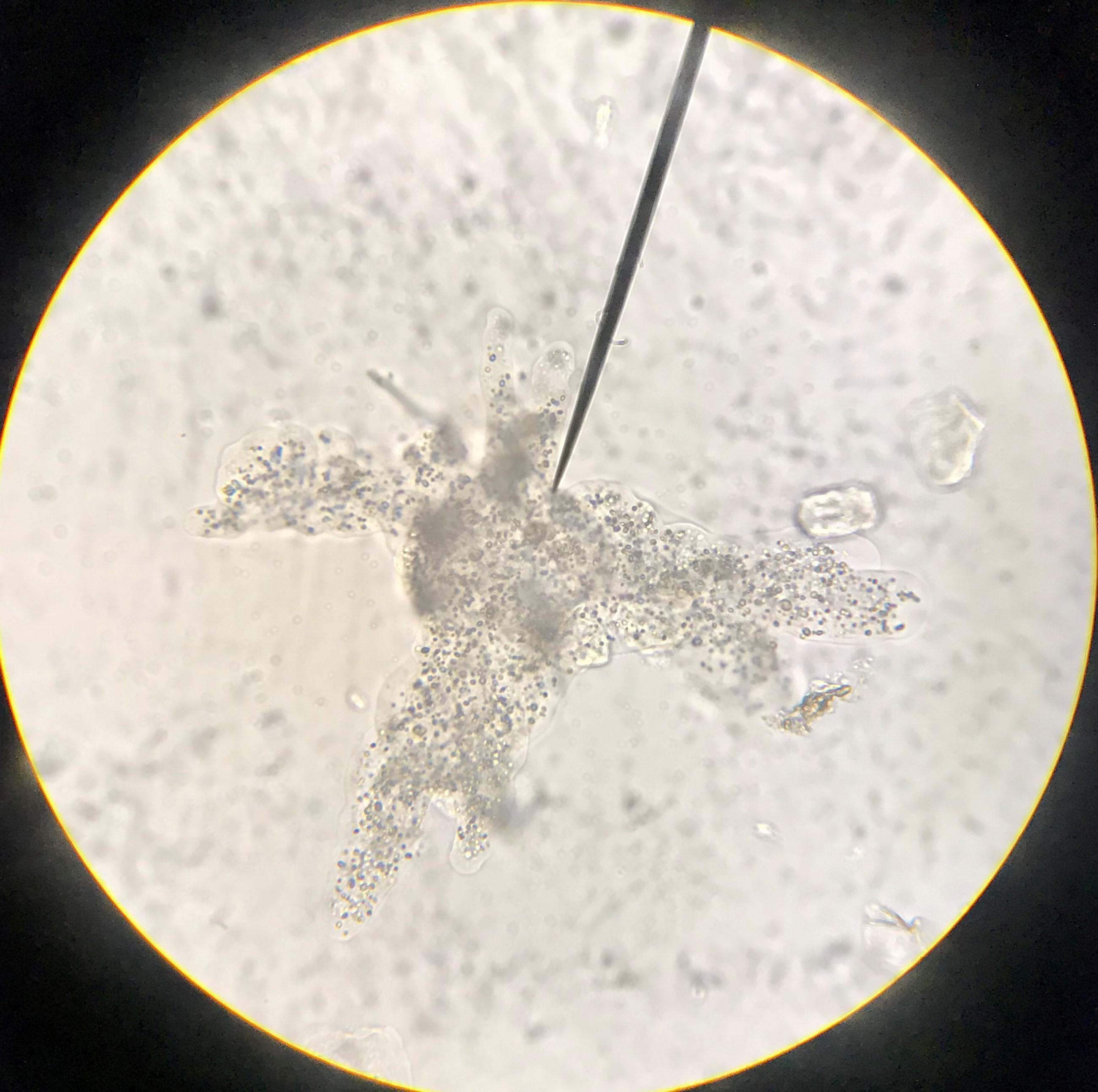 Amoeba Under Microscope 10x