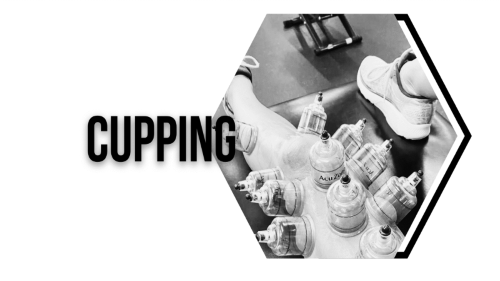 Cupping – Athletic Training – Hackettstown High School